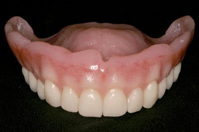 Dentures in West & North Vancouver - Partial or Full Sets